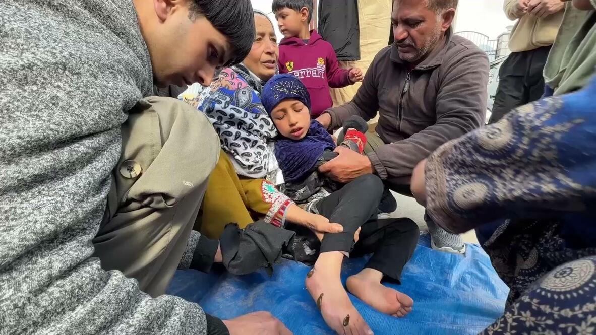 Healing heritage – Hundreds embrace traditional leech therapy on Nowruz ...