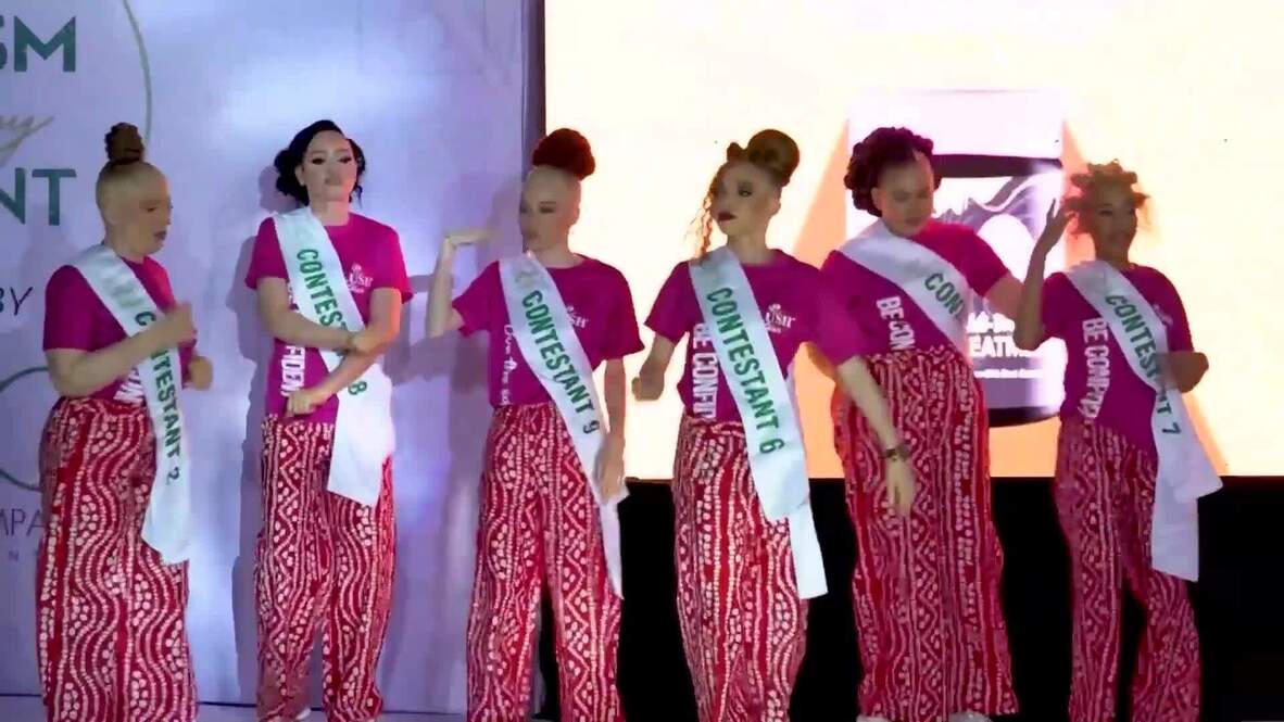 Celebrating diversity - Nigeria hosts 2025 Albinism Advocacy Pageant to ...